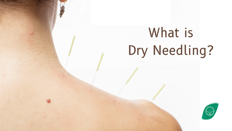 What is Dry Needling?